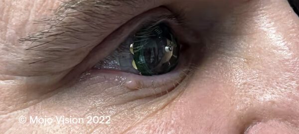Mojo Vision; Learn About Mojo Smart Contact Lenses